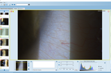 Slit lamp imaging