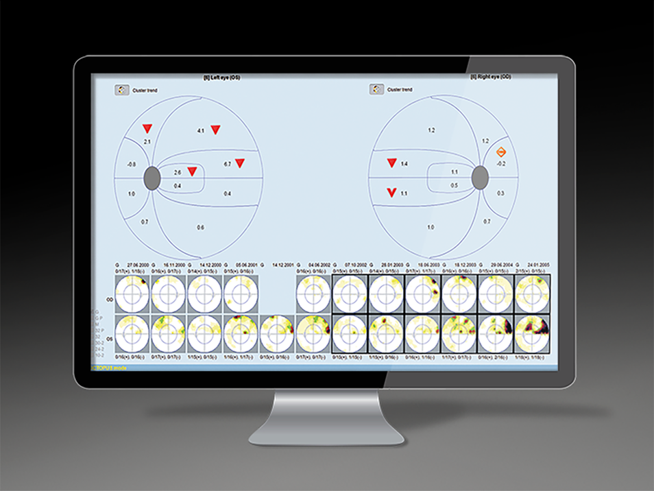 EyeSuite - View patient data comfortably from your office