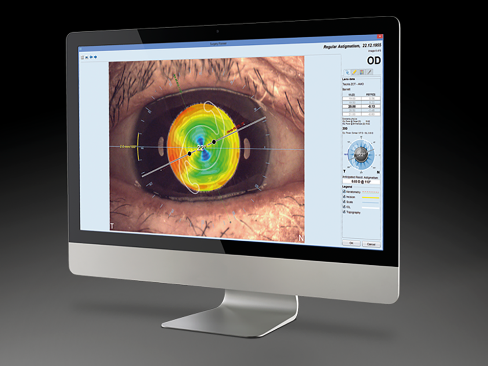 EyeSuite - View patient data comfortably from your office