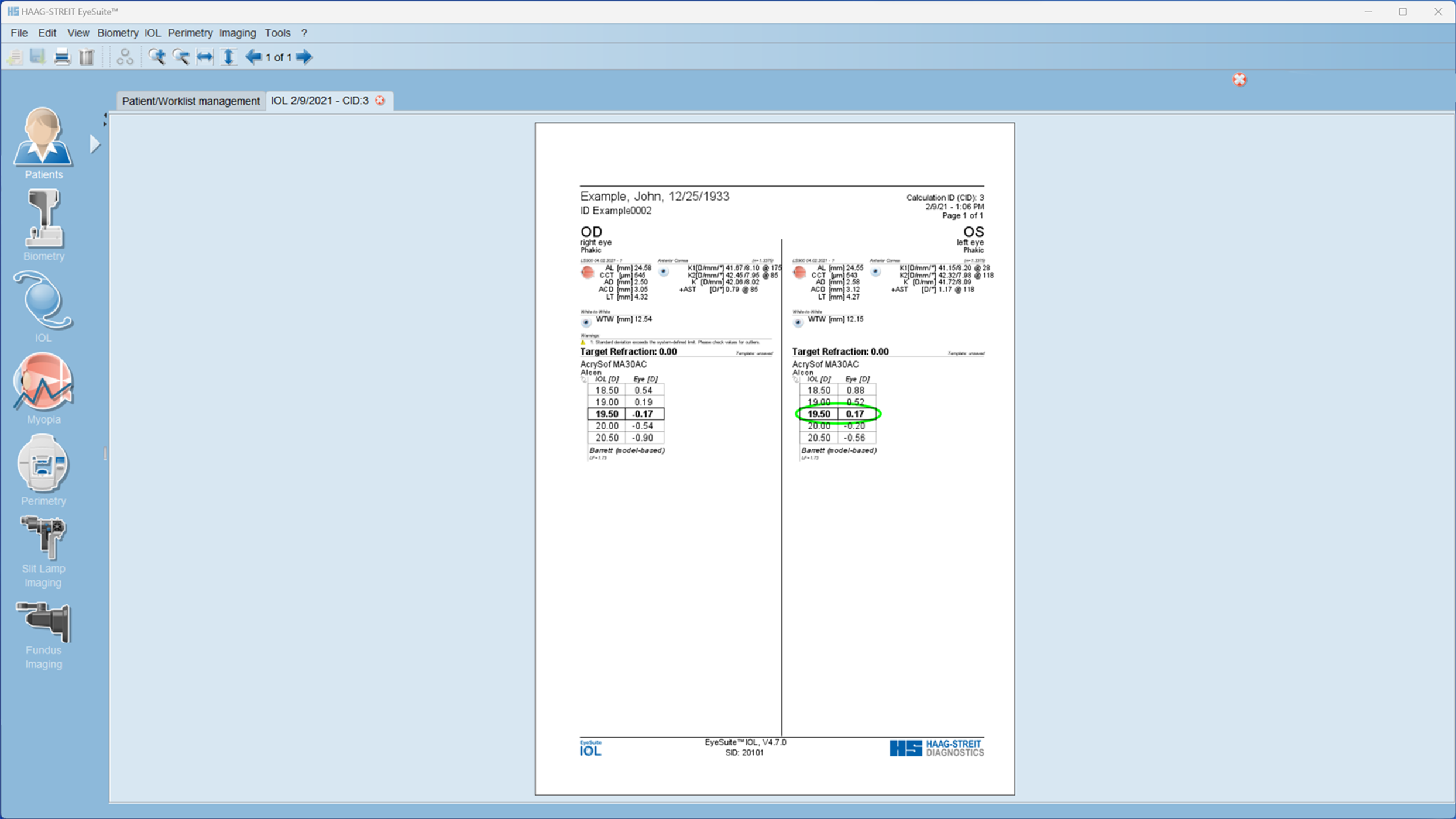 Lenstar 900 - EyeSuite IOL