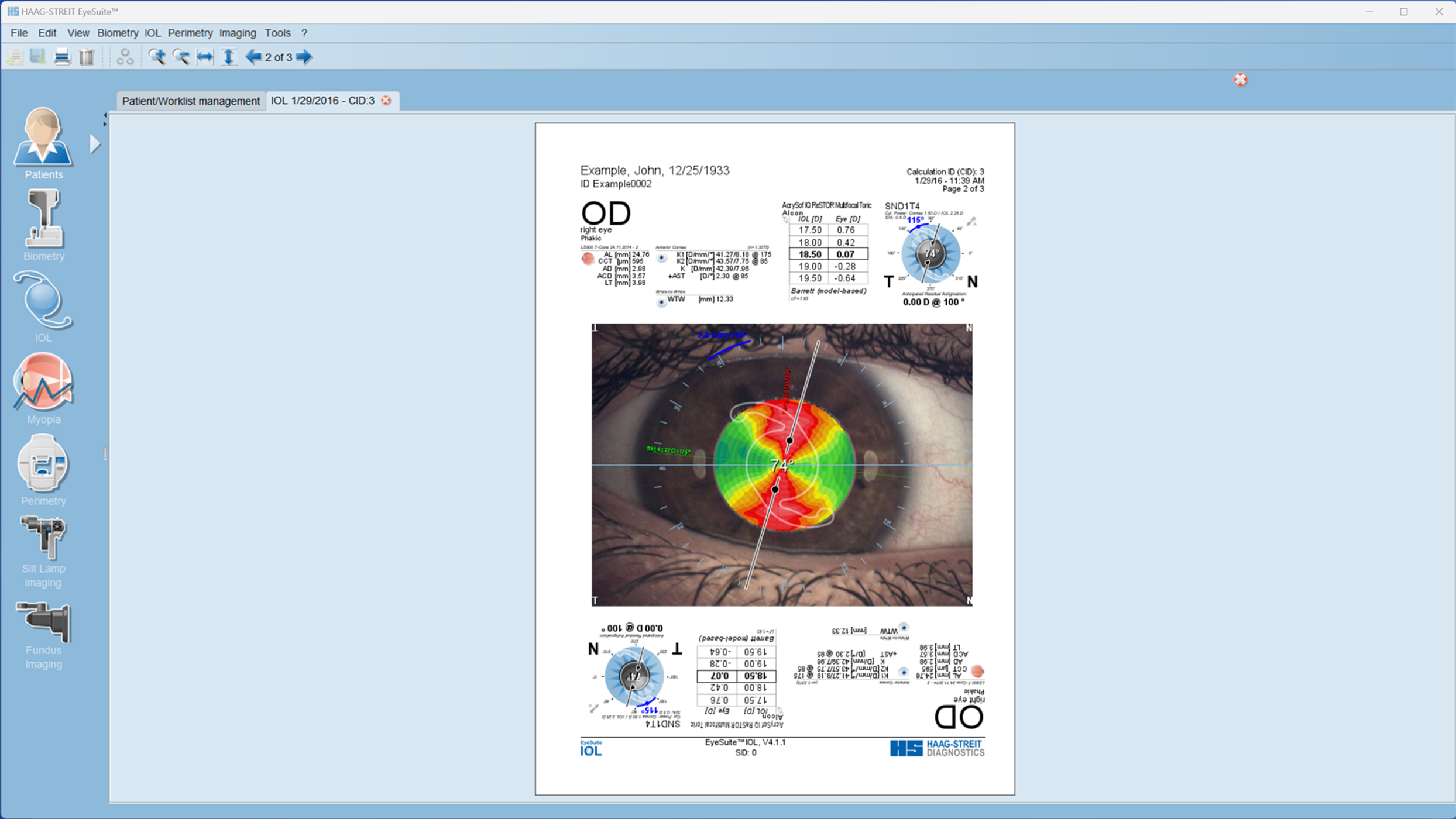 Lenstar 900 - EyeSuite IOL