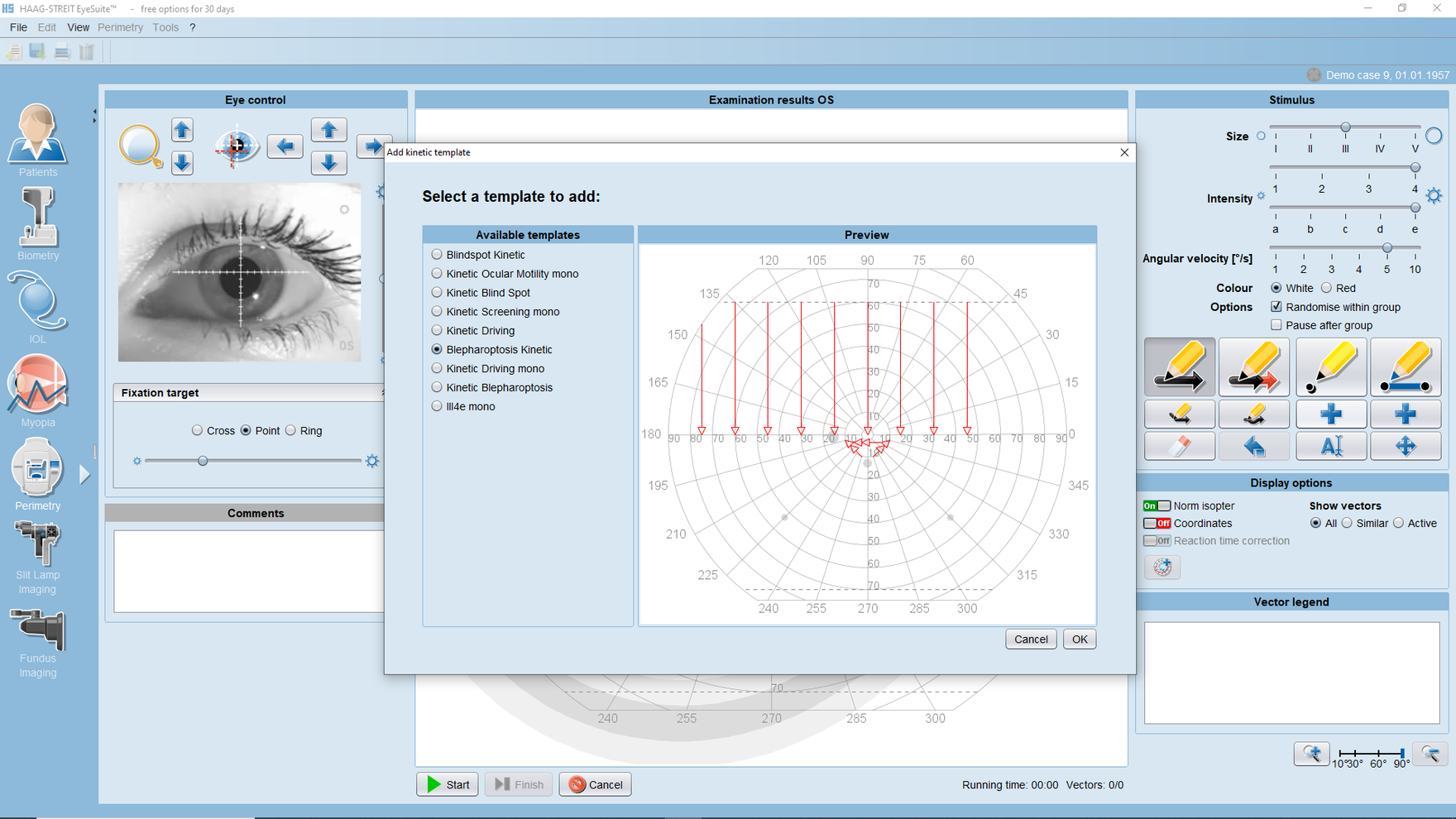Octopus 900 - Kinetic perimetry