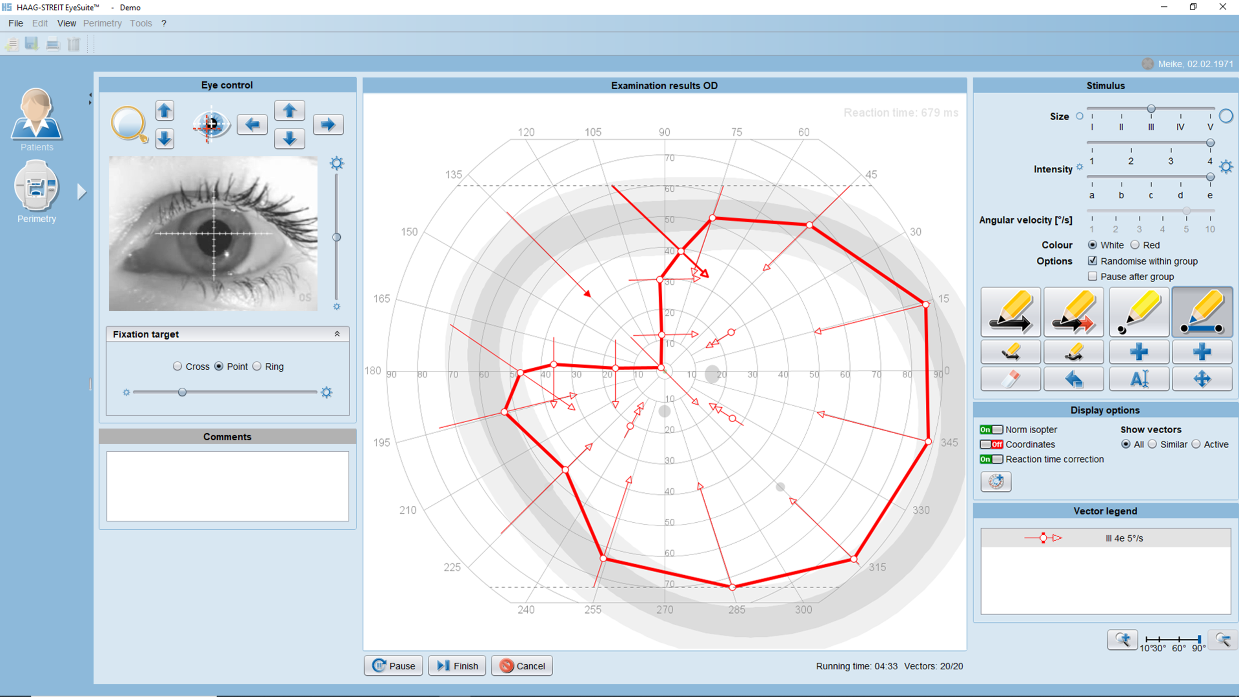 Octopus 900 - Kinetic perimetry