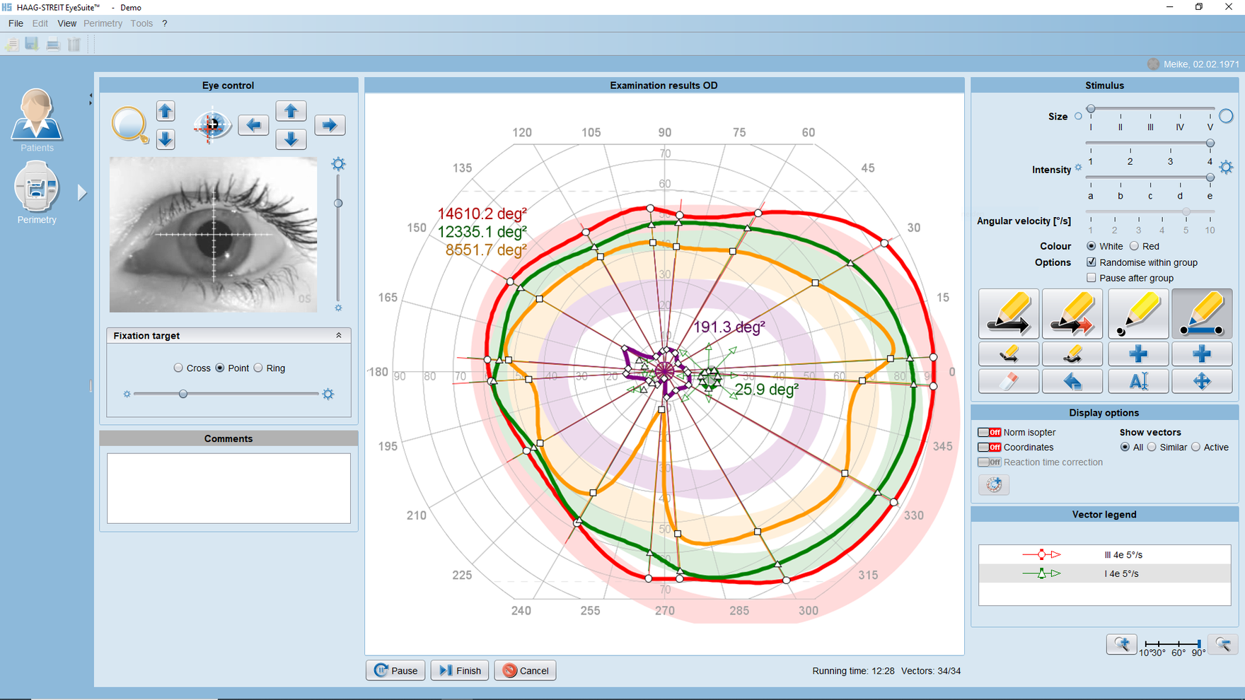Octopus 900 - Kinetic perimetry