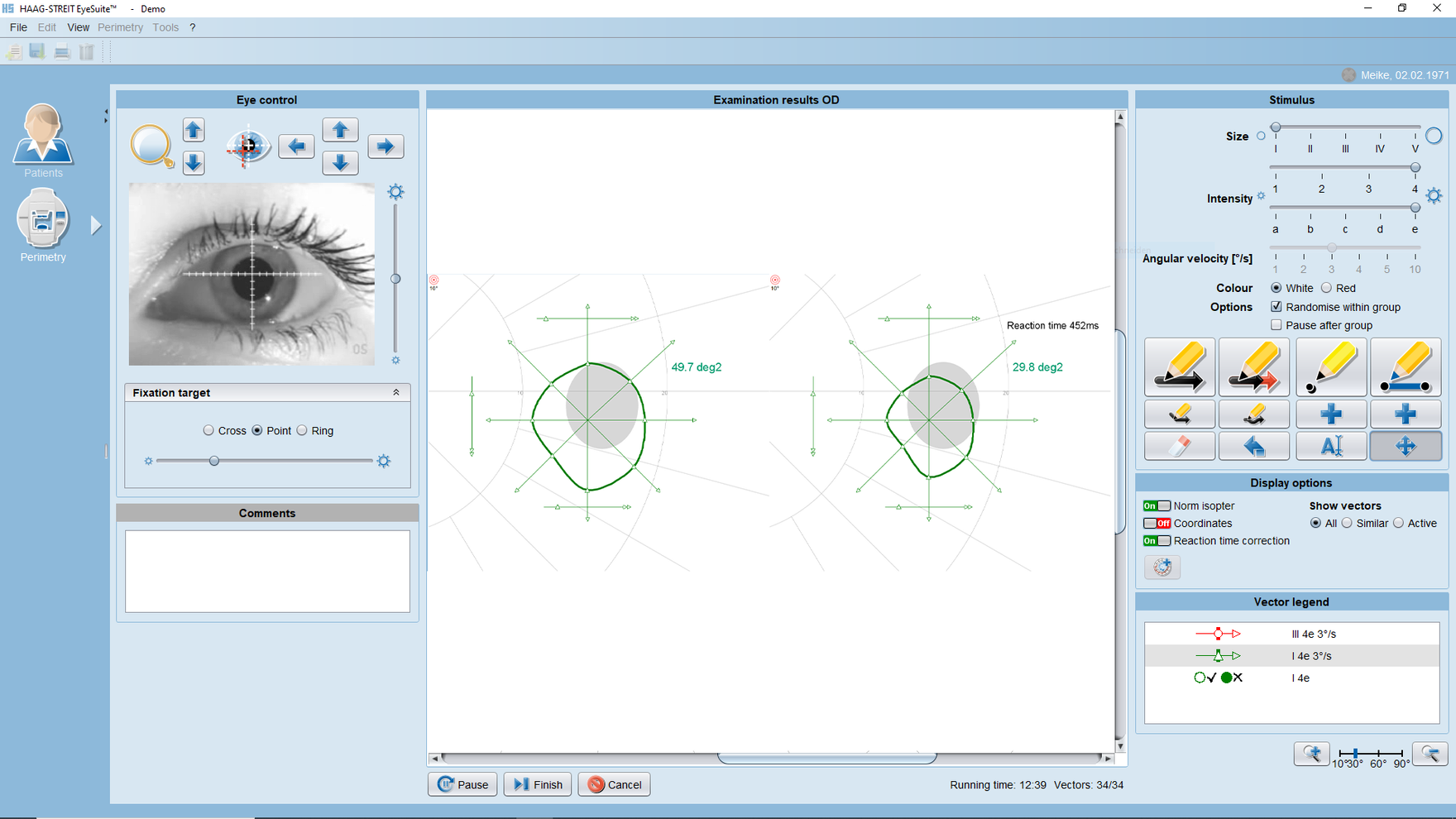 Octopus 900 - Kinetic perimetry
