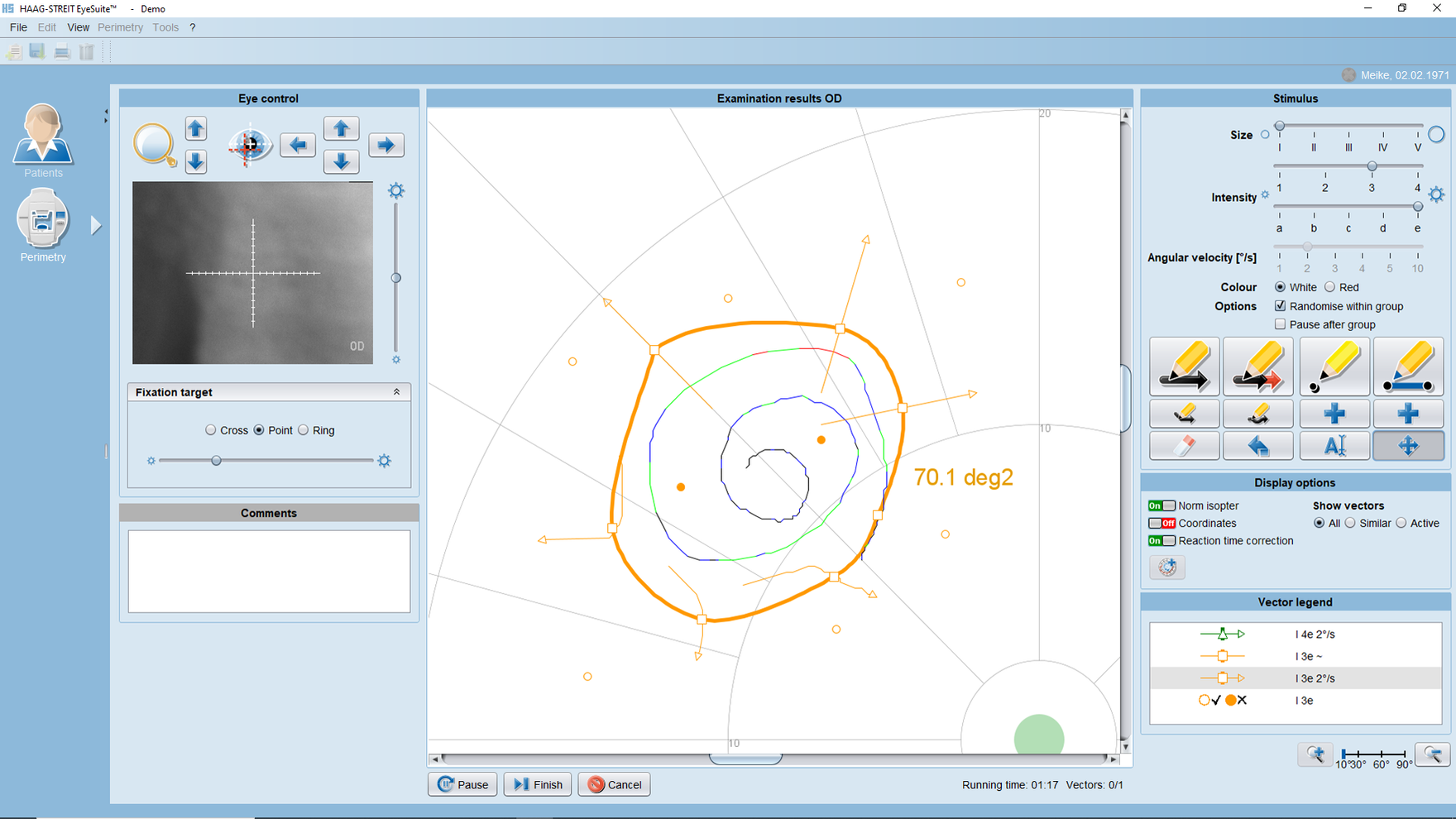 Octopus 900 - Kinetic perimetry