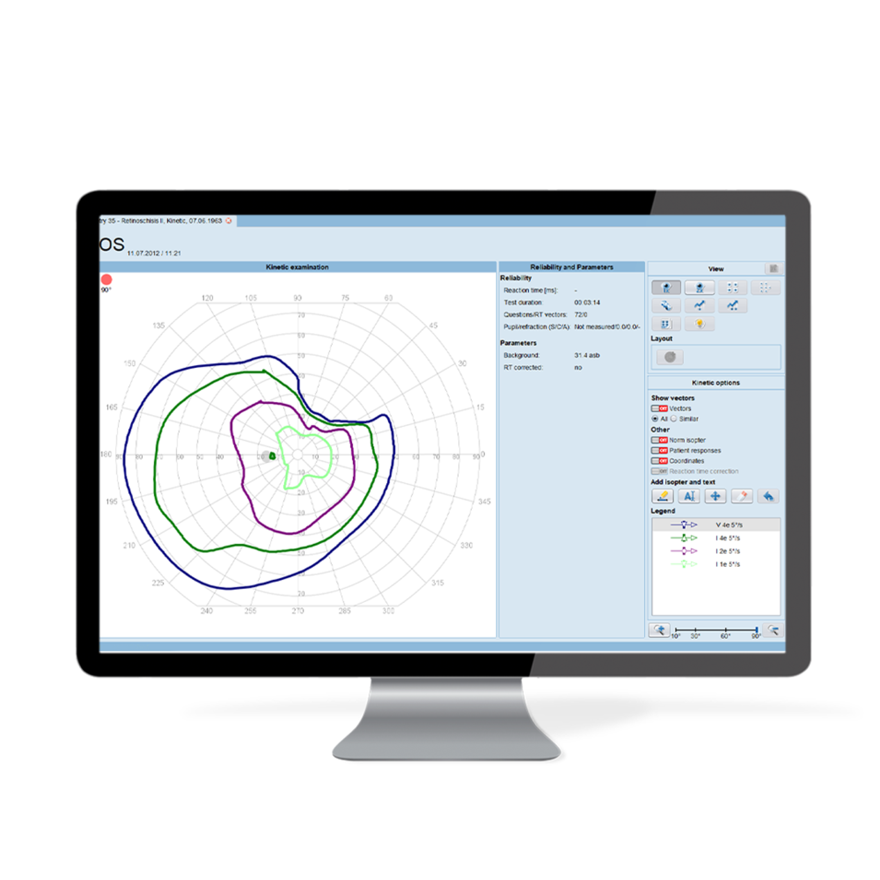 Octopus 900 - Kinetic perimetry