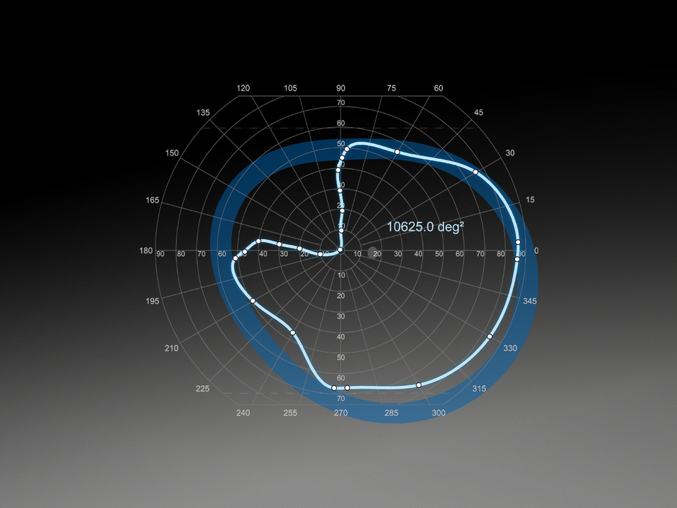 Octopus 900 - Kinetic perimetry